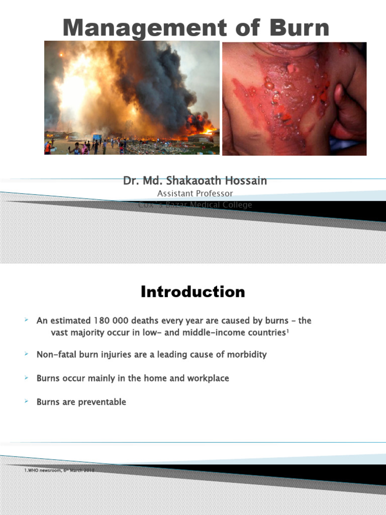Management of Burn | Download Free PDF | Burn | Wound