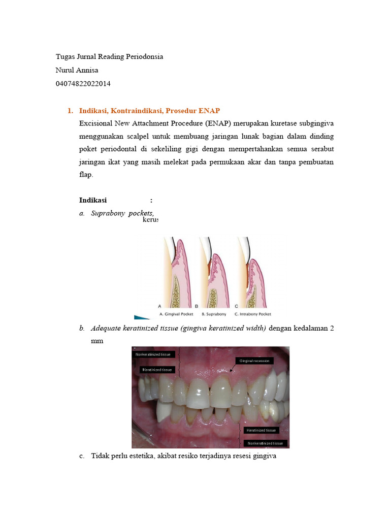 Tugas Jurnal Reading Perio.. | PDF