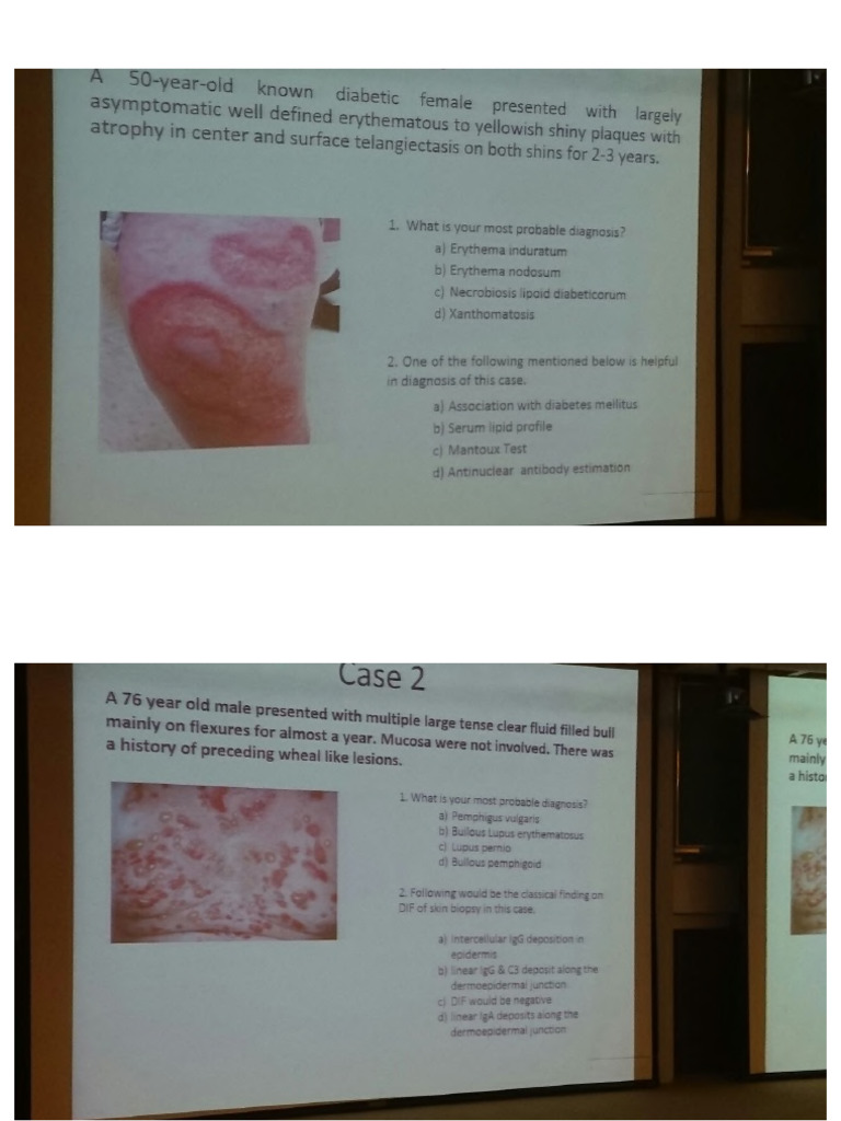 Dermatology OSCE | PDF