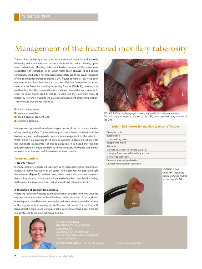 Management of The Fractured Maxillary Tuberosity | PDF | Mouth ...