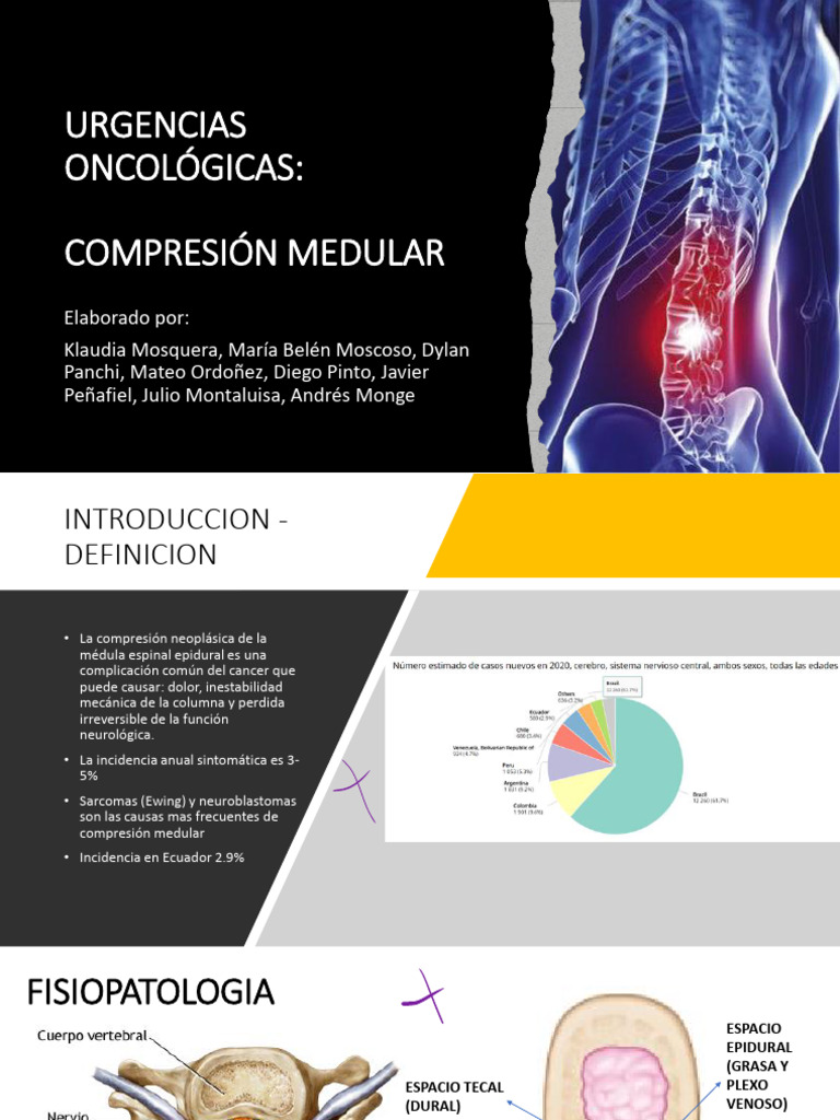 Compresion Medular | PDF | Cáncer | Cáncer de mama