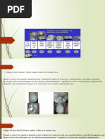 Códigos ICDAS para Caries y Restauraciones | PDF | Esmalte de dientes ...