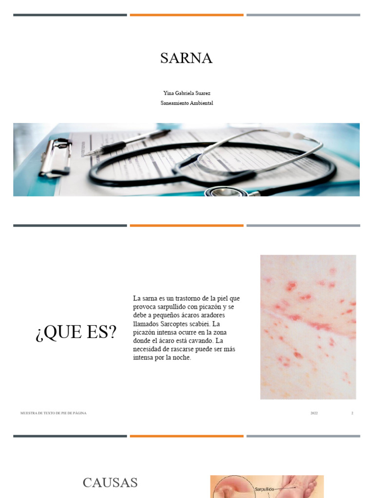 Sarna: Causas, Consecuencias y Tratamiento | PDF | Enfermedades y ...