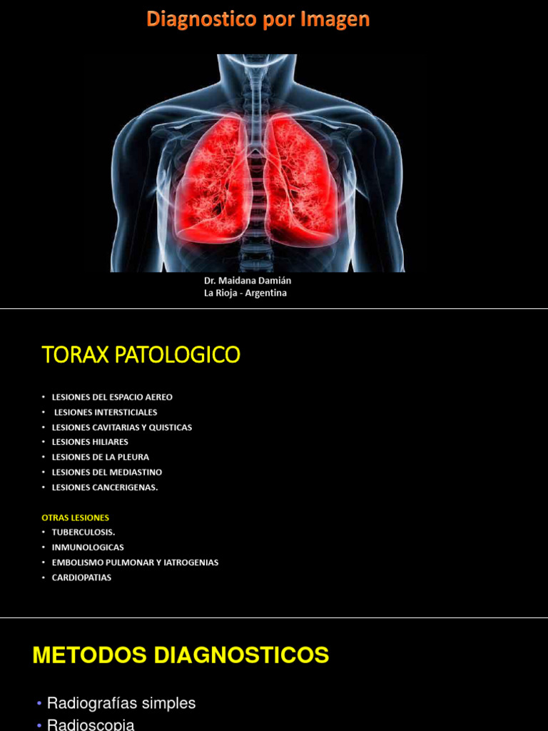Lesiones Torácicas y Diagnóstico Médico | PDF | Neumonía | Causas de la ...