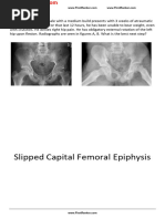 Drehmann Sign and Femoro Acetabular Impingement In.7 | PDF | Hip ...