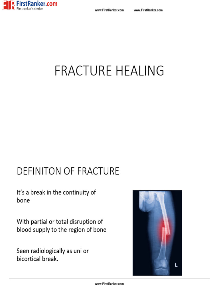 Understanding Fracture Healing and Repair | PDF | Bone ...