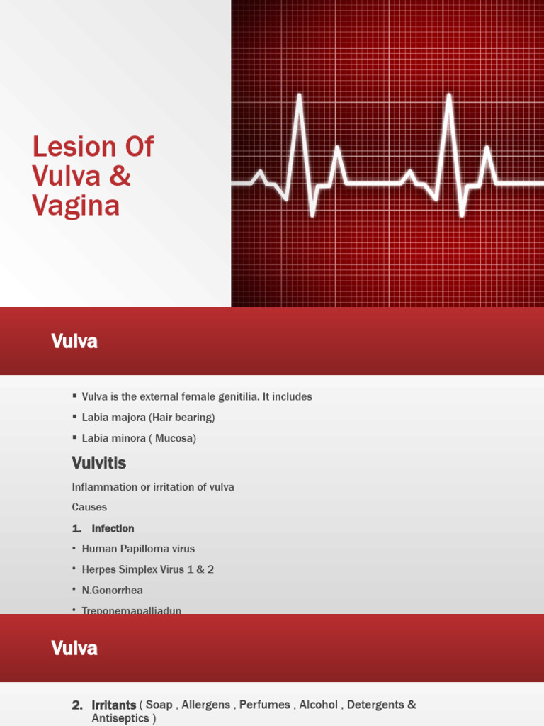 Vulvar and Vaginal Lesions Overview | PDF | Vagina | Neoplasms