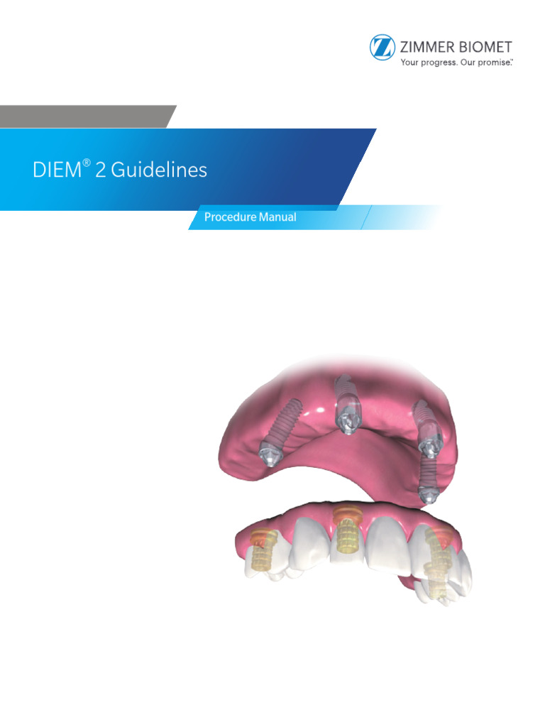DIEM2+Guidelines+Procedural+Manual ZBINST1159 | PDF | Dental Implant ...