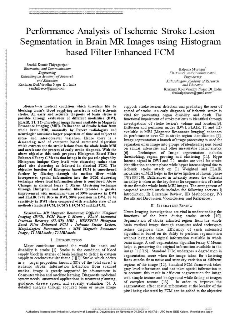 Performance Analysis Of Ischemic Stroke Lesion Segmentation In Brain Mr Images Using Histogram