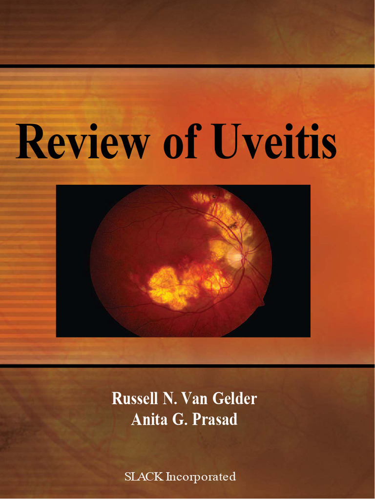 Review of Uveitis 240709 000245 | PDF | T Helper Cell | Antibody