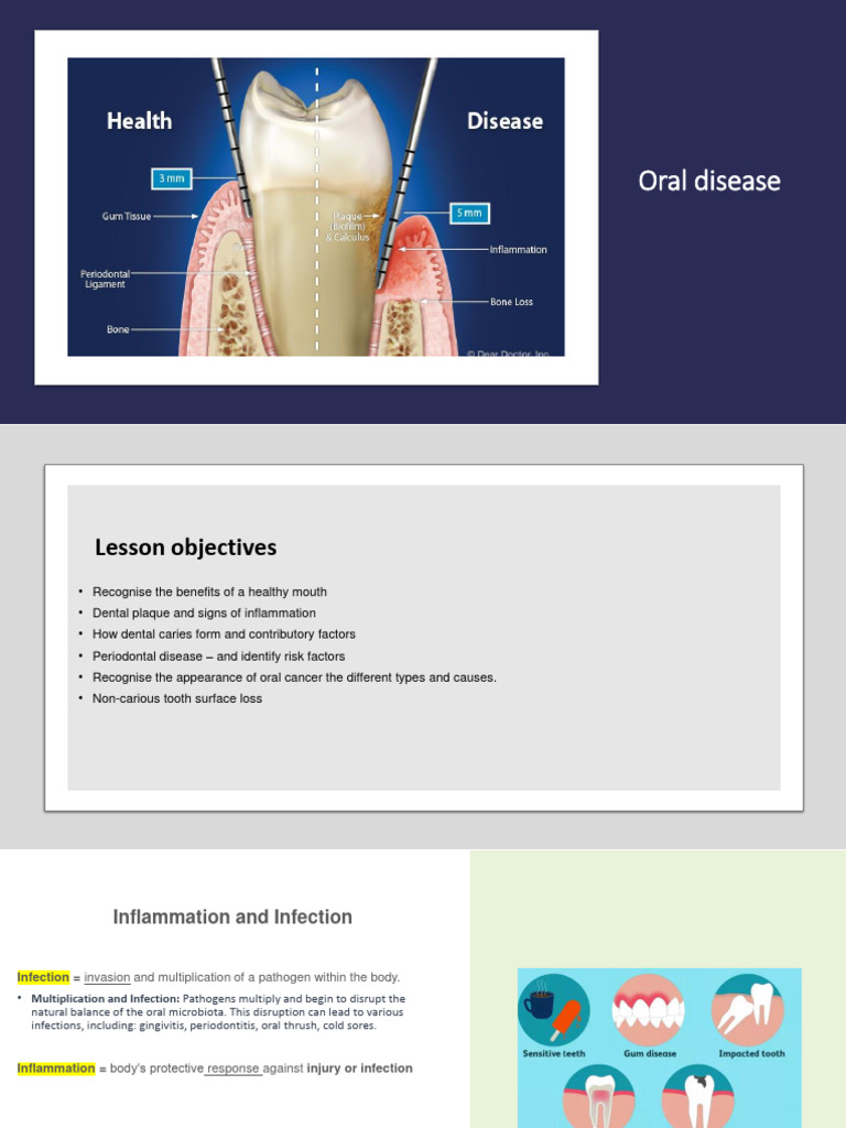 Oral Diseases | PDF | Periodontology | Human Tooth