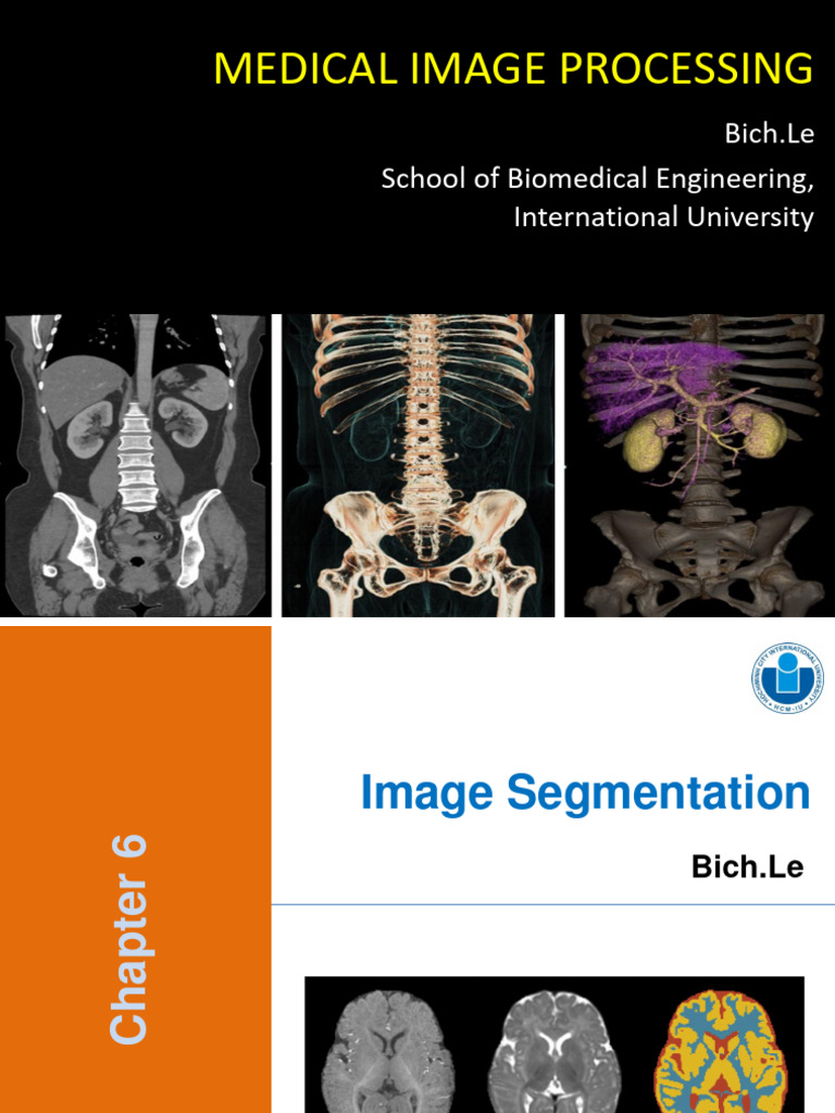Chap 6 Image Segmentation Pdf Image Segmentation Computer Science