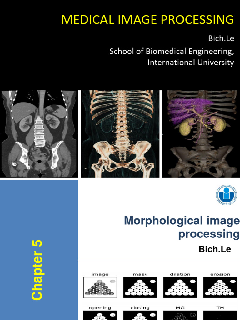 CHAP 5 Morphological Image Processing | PDF | Multidimensional Signal Processing | Computer Vision