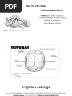 Asinclitismo en el Parto: Definición y Tipos | PDF