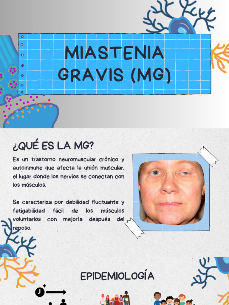 Miastenia Gravis: Síntomas y Tratamiento | PDF | Unión neuromuscular ...