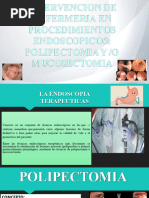 Suboclusion Intestinal | PDF | Enfermedades digestivas | Gastroenterología