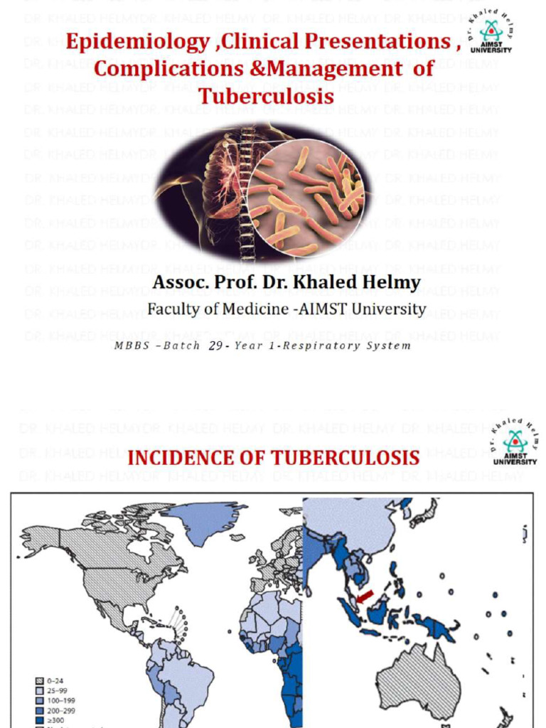P-2024 - MBBS - Batch 29 Year 1 - TB Epidemiology - Clinical ...