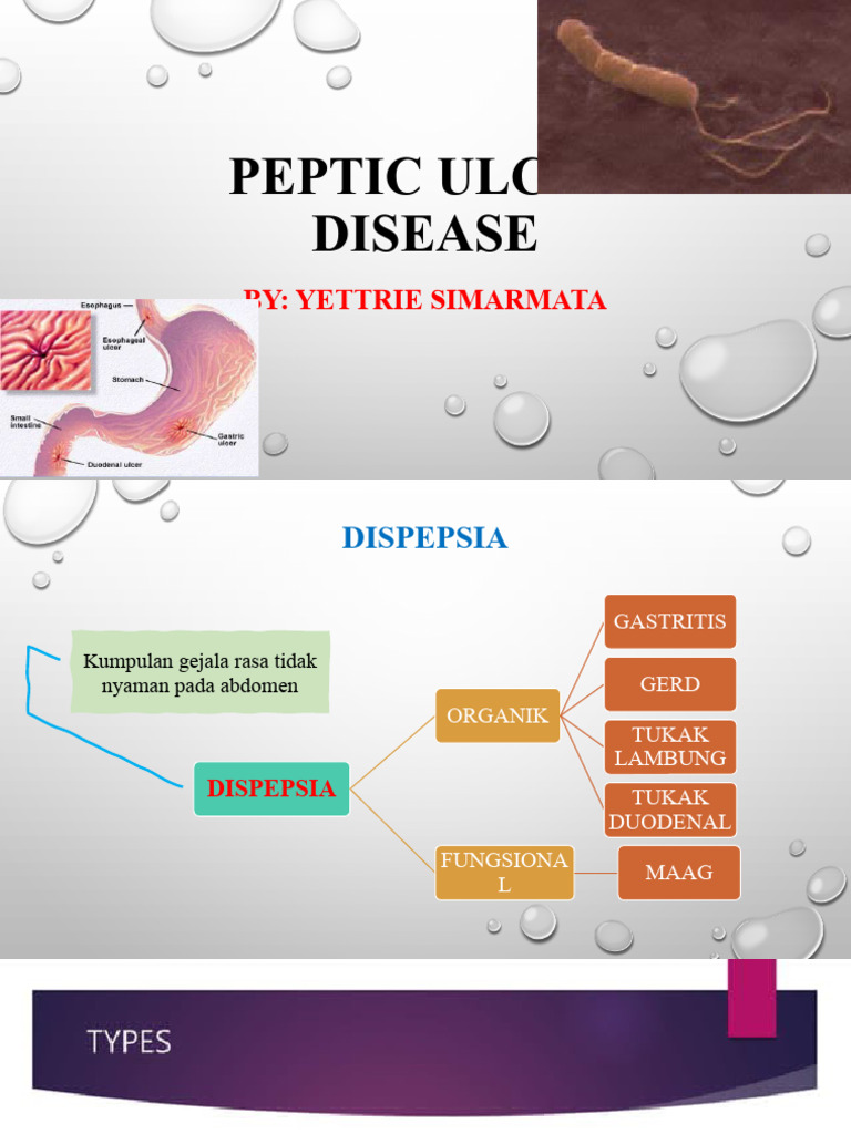 Pertemuan 10. Peptic Ulcer Disease | PDF