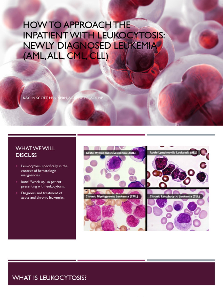 AML, CML, ALL, CLL | PDF | Leukemia | White Blood Cell
