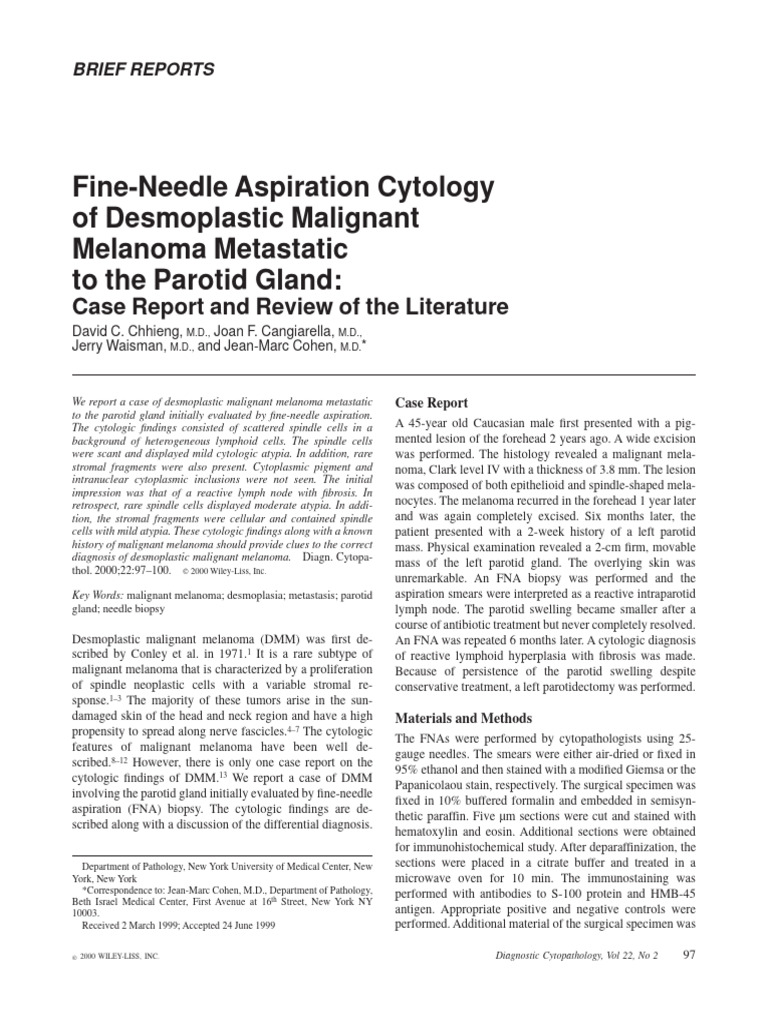Fine-Needle Aspiration Cytology of Desmoplastic Malignant Melanoma ...