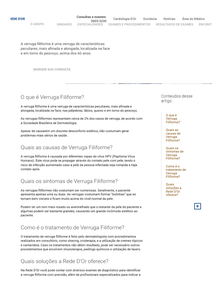 Verruga Filiforme_ O Que é, Sintomas, Tratamentos e Causas. | PDF ...