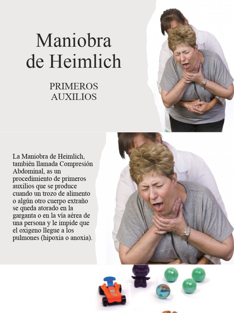 Maniobras de Heimlich | PDF | Reanimación cardiopulmonar
