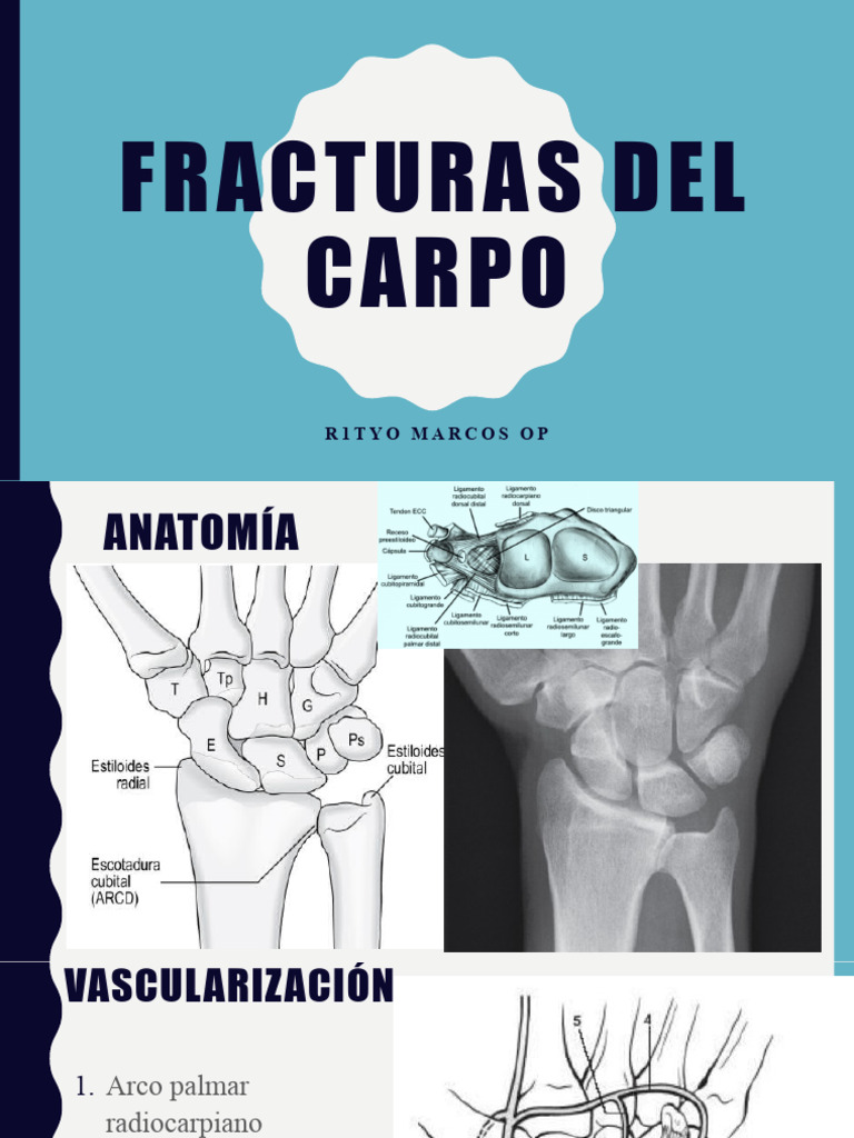 Fracturas del Carpo: Anatomía y Tratamiento | PDF | Mano | Extremidades ...
