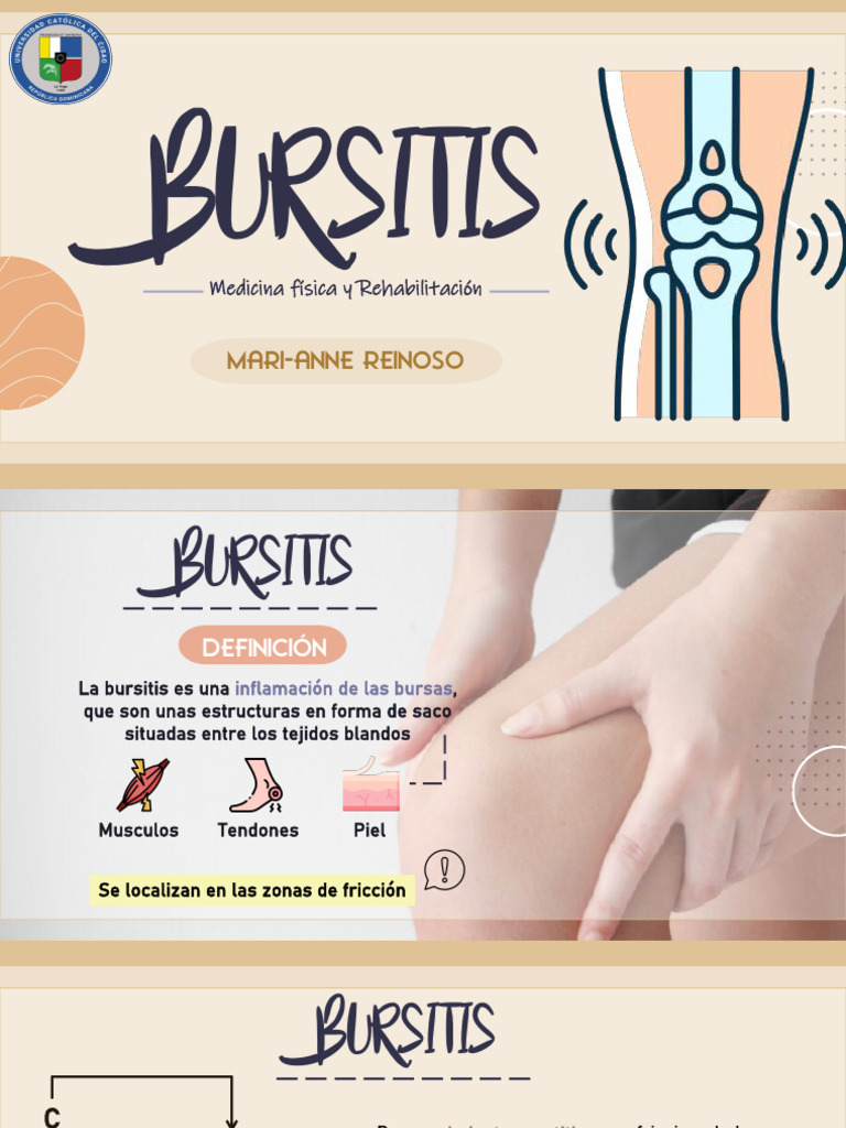 Bursitis - Diapositiva | Descargar gratis PDF | Rodilla | Medicina CLINICA