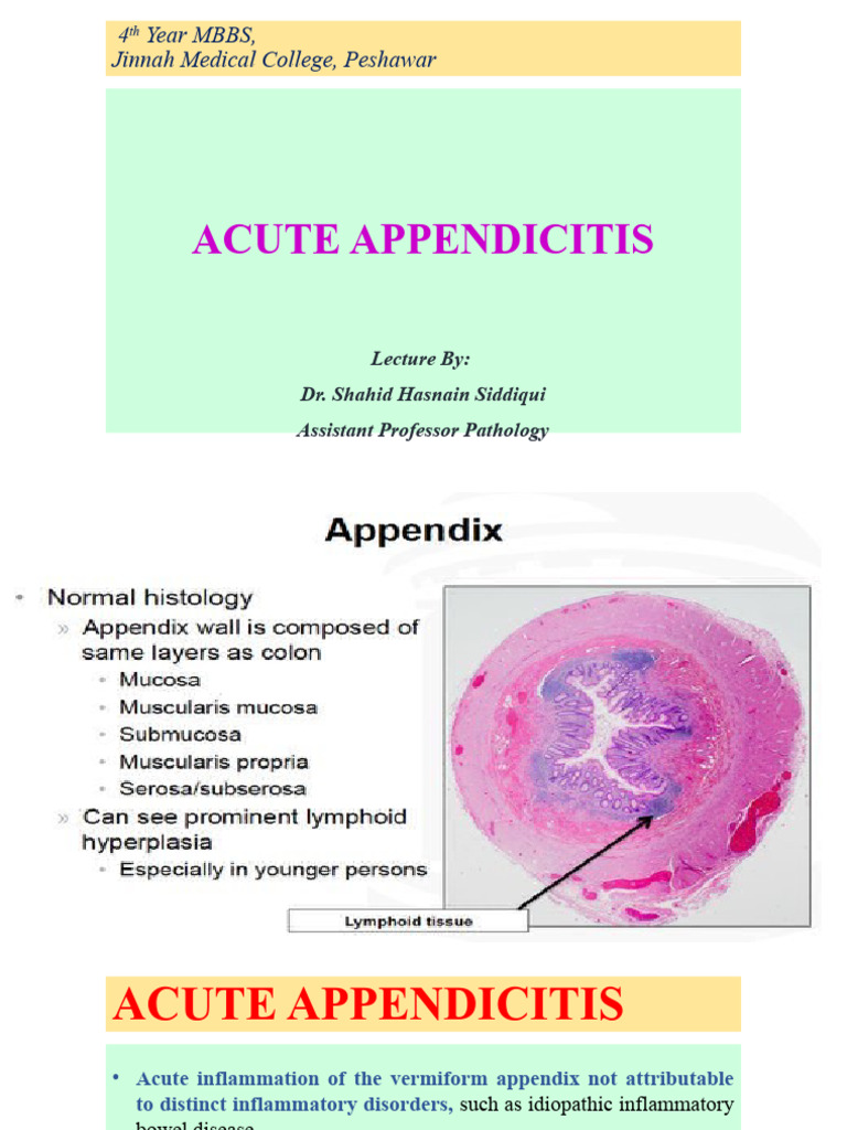 Acute Appendicitis | PDF | Inflammation | Clinical Medicine