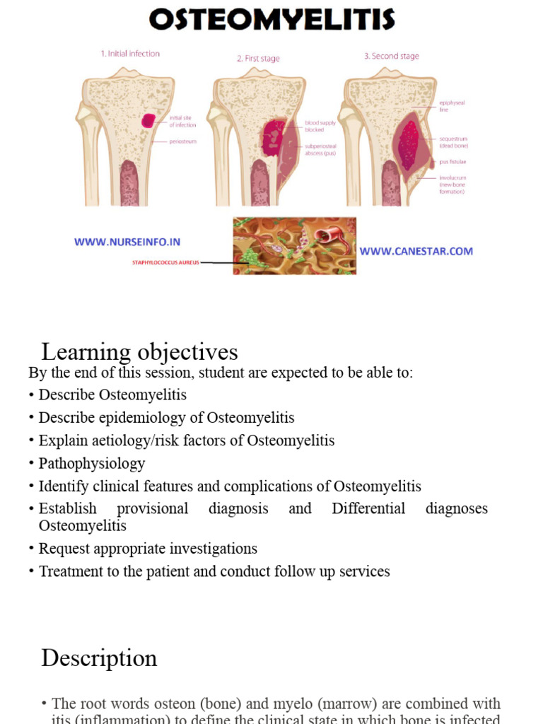 Session 10-OSTEOMYELITIS | PDF | Infection | Medicine