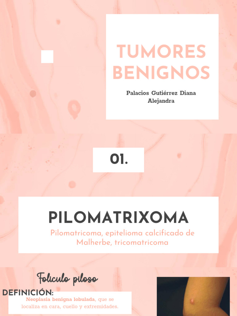 Tumores Benignos | PDF | Neoplasias | Enfermedades y trastornos