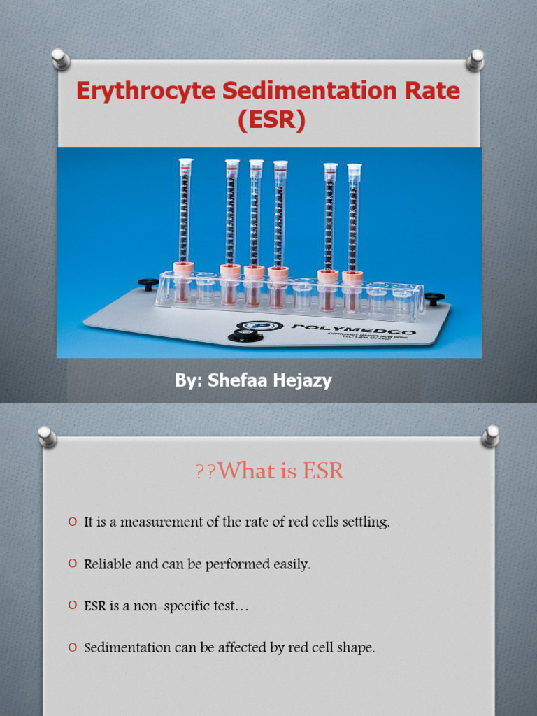 Understanding Erythrocyte Sedimentation Rate | PDF | Causes Of Death ...