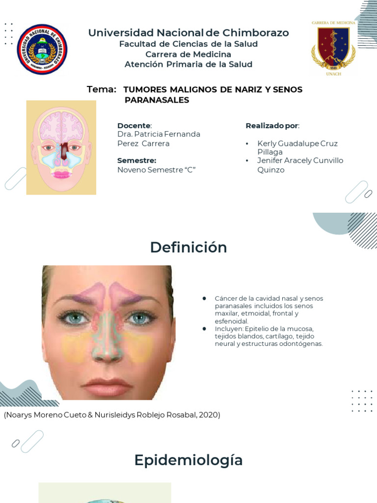 Tumores Malignos de Nariz y Senos Paranasales | PDF | Cáncer | Cáncer de mama