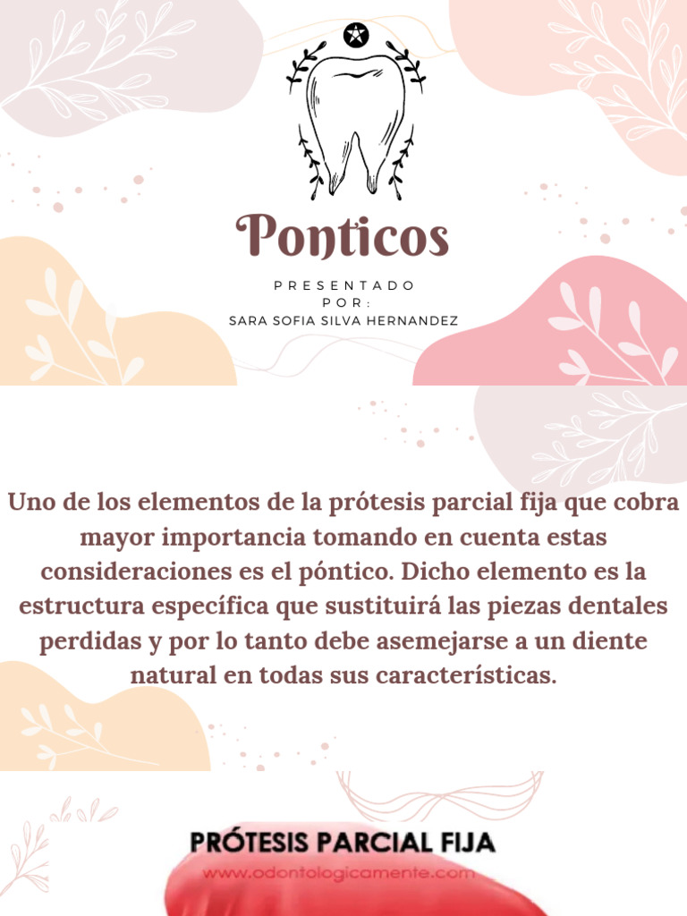 Pontico Expo Ricardo | PDF | Anatomia dental | Diente