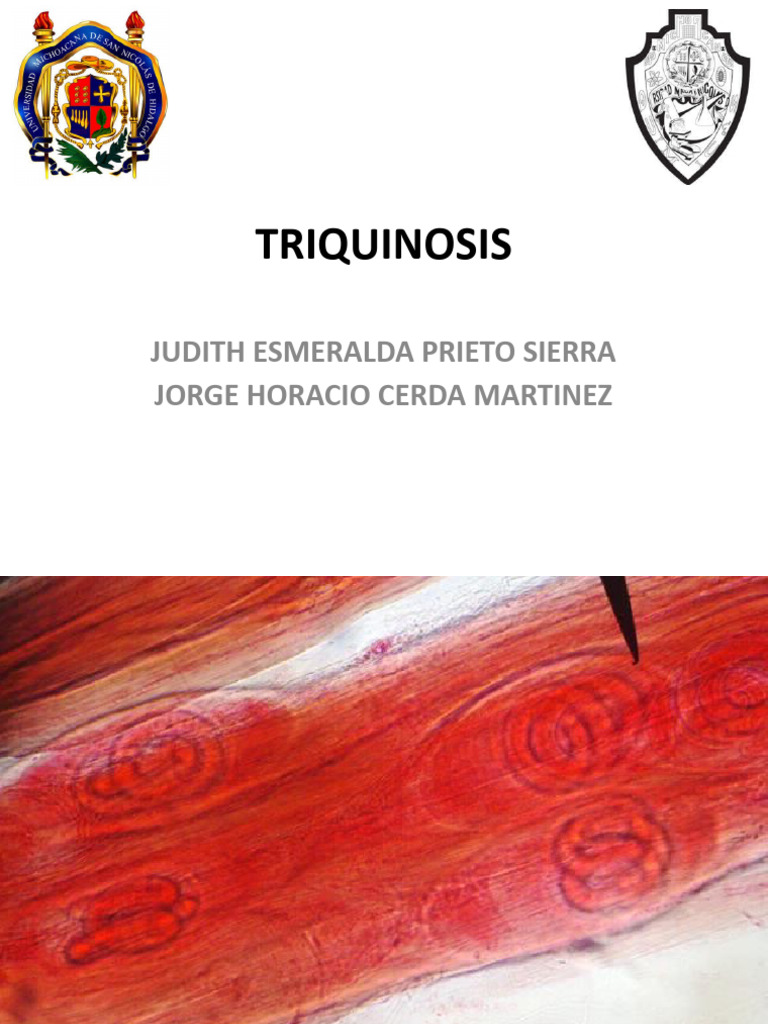 Triquinosis | PDF | Enfermedades y trastornos | Medicina CLINICA