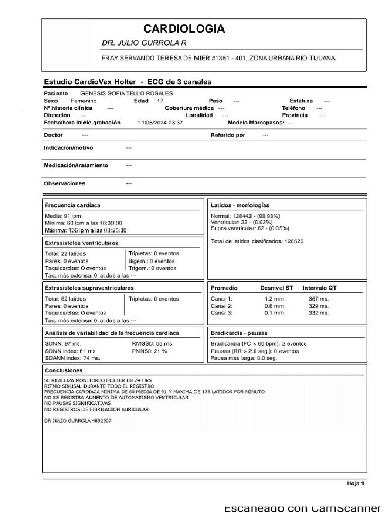 Tello Rosales Genesis Sofia - Informe Holter | PDF