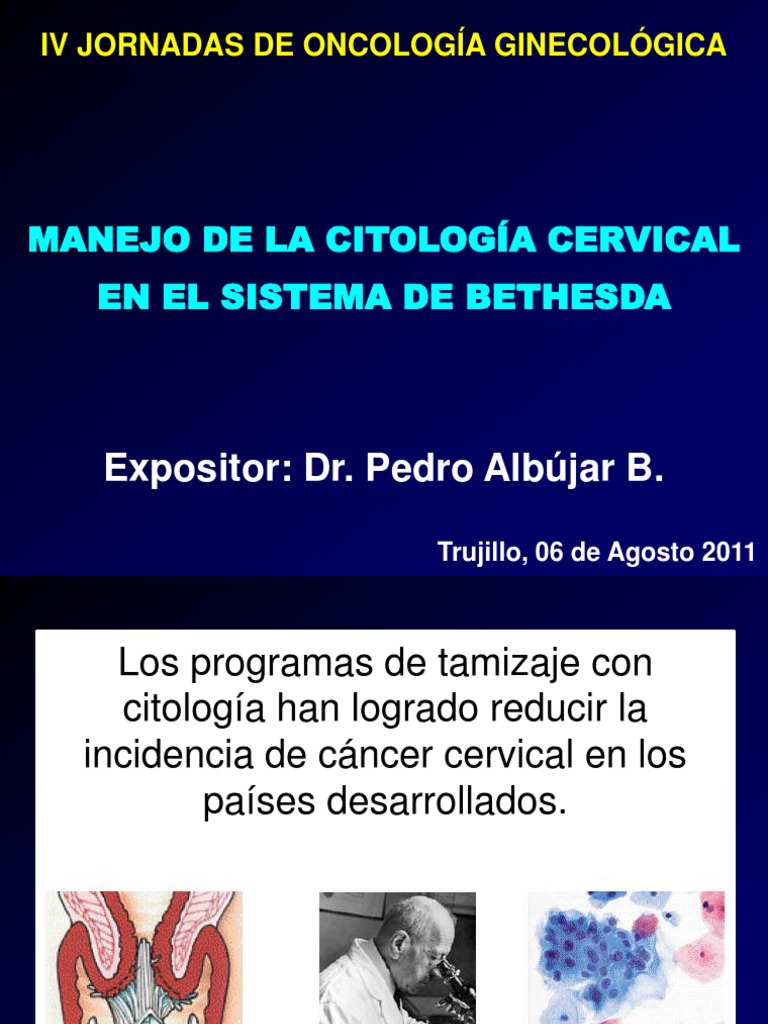 MANEJO SISTEMA BETHESDA | Cáncer de cuello uterino | Cáncer