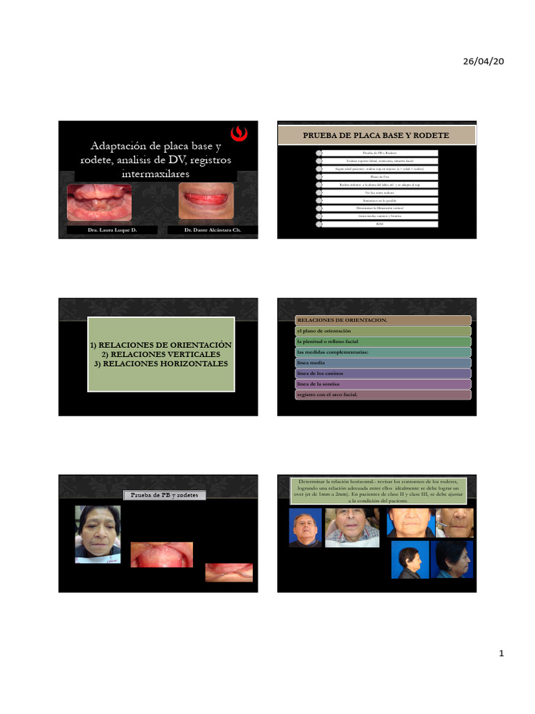 Adap Placa base - Analisis DV Registros en prótesis total | PDF