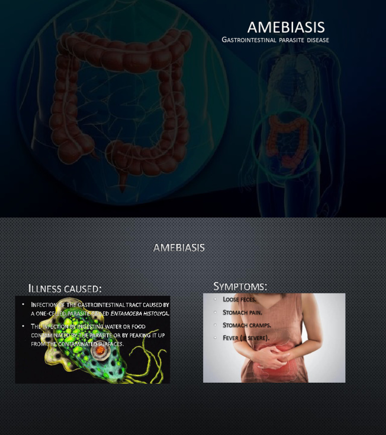 Amebiasis English Project | PDF