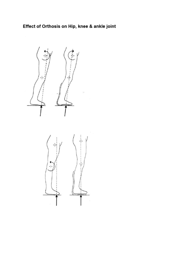 Effect of Orthosis On Hip, Knee & Ankle Joint | PDF