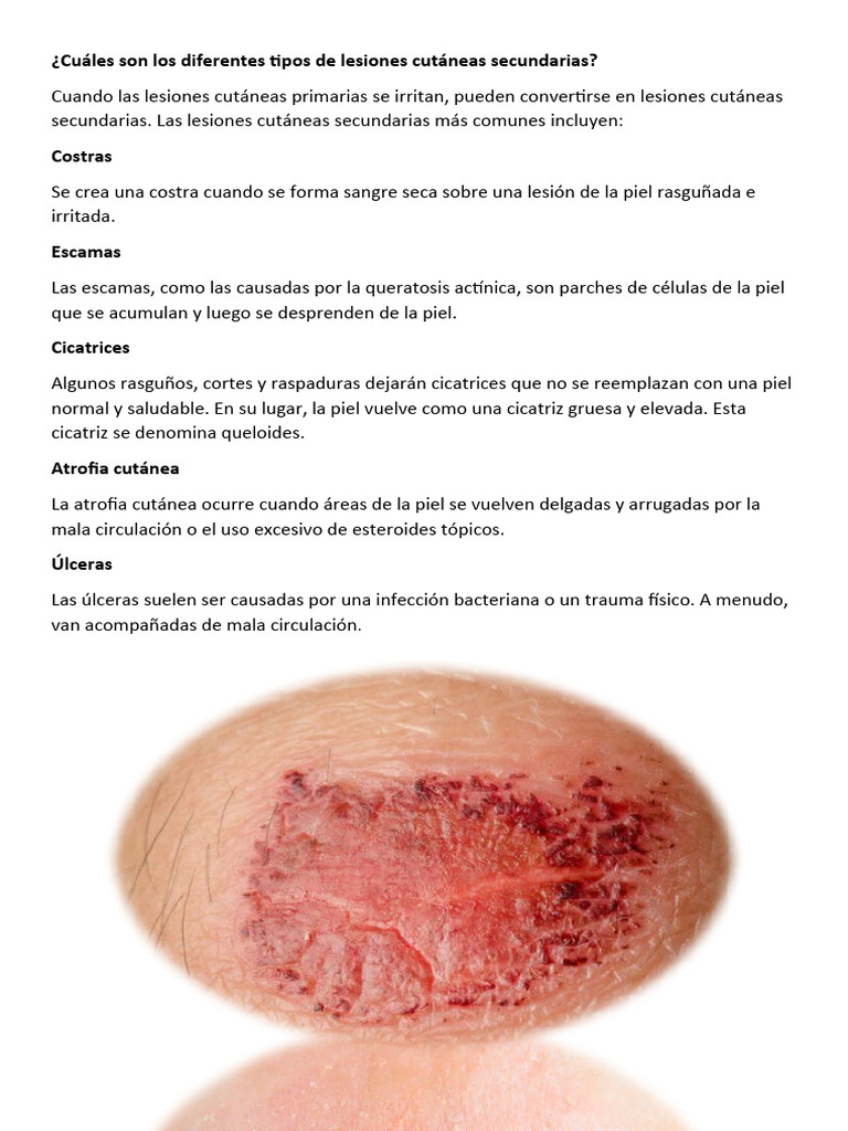 Cuáles Son Los Diferentes Tipos De Lesiones Cutáneas Secundarias Pdf