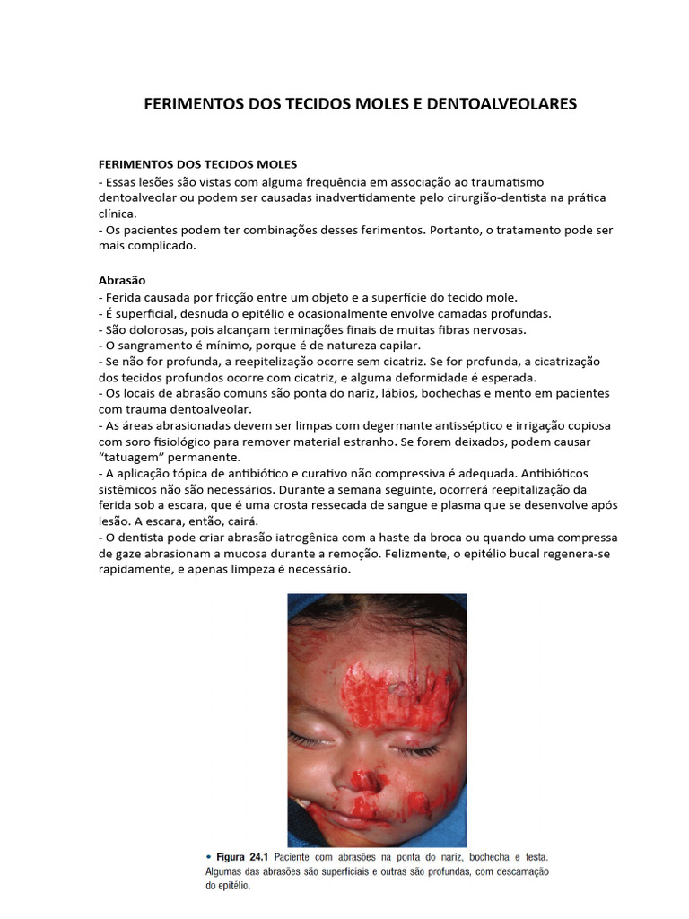 Ferimentos Dos Tecidos Moles e Dentoalveolares | PDF | Dente humano ...