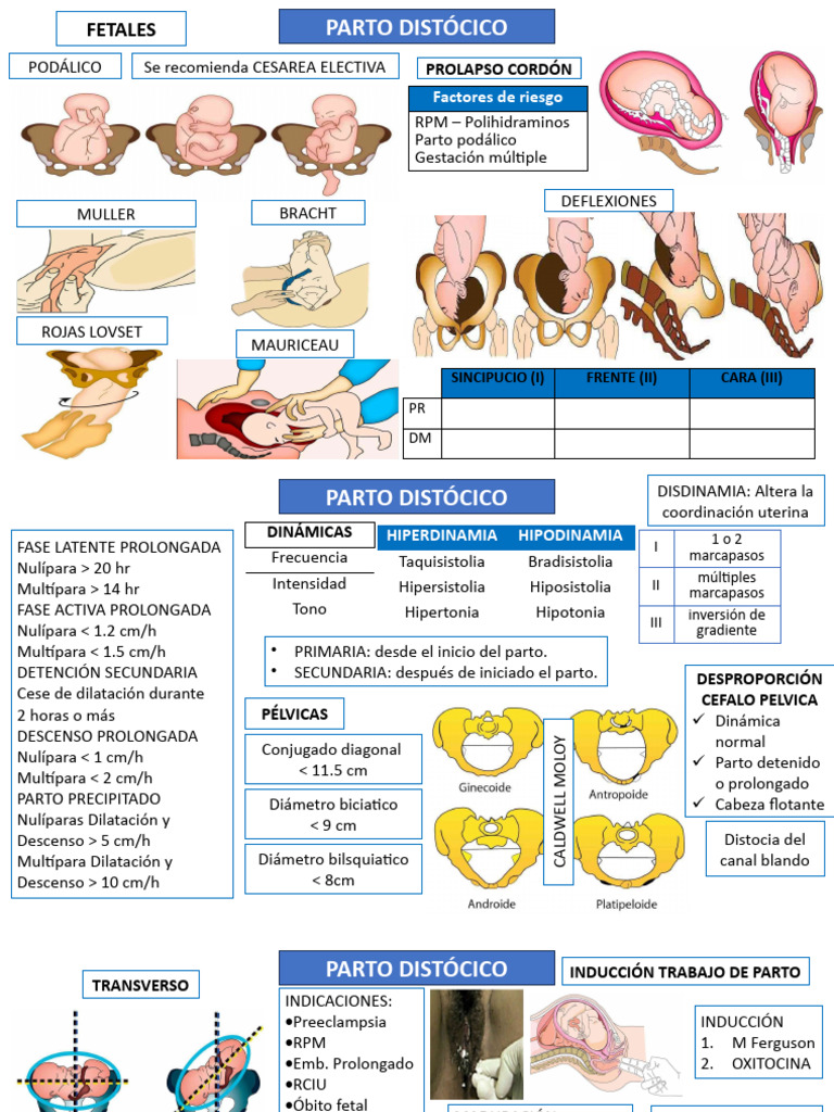 Parto Distócico | PDF | Parto | Cuidado de la salud