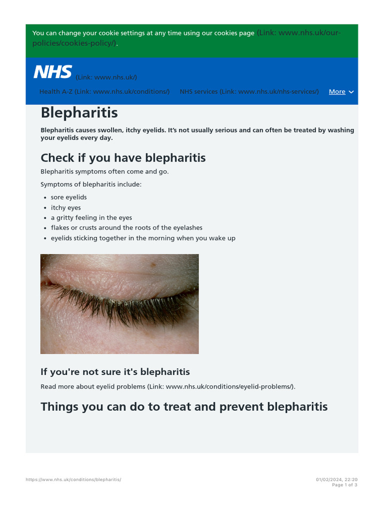 Blepharitis - NHS | Download Free PDF | Diseases And Disorders | Ophthalmology