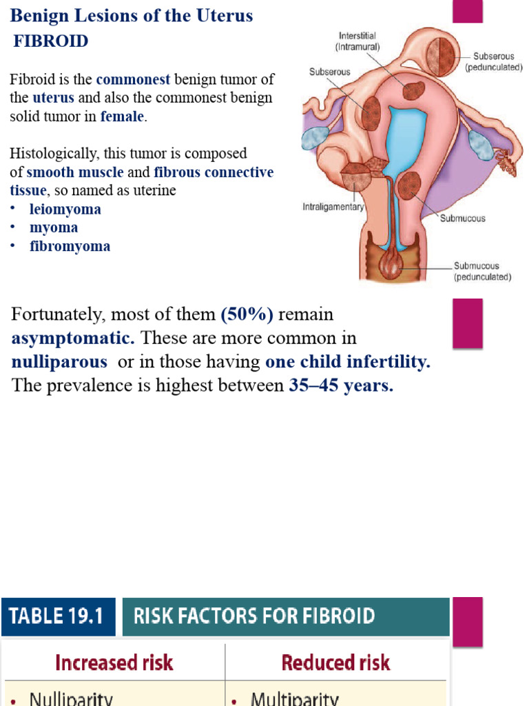 Fibroid 1 | PDF | Uterus | Human Reproduction