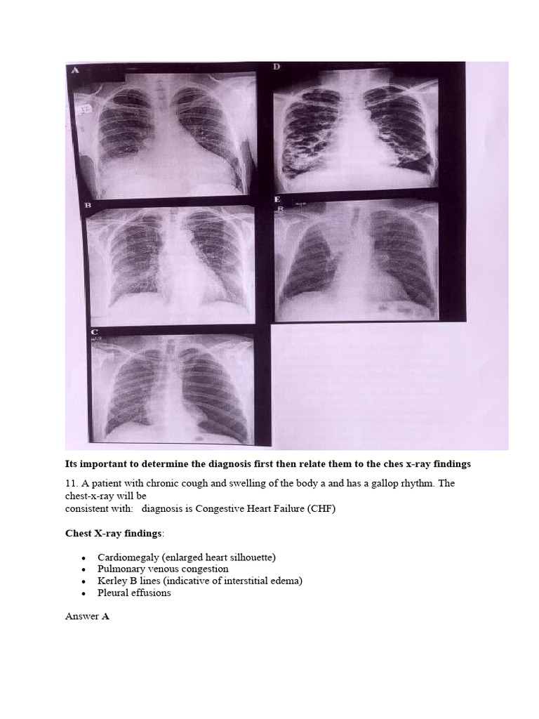 Matching Chest X Ray | PDF | Wellness | Science & Mathematics