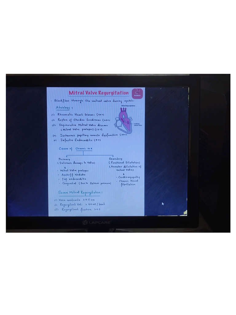 MVR | PDF