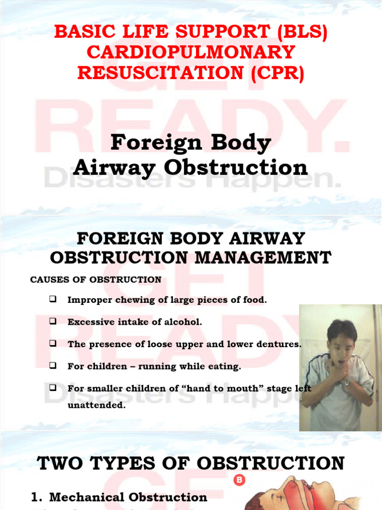 Module 14 Foreign Body Airway Obstruction | PDF | Wellness