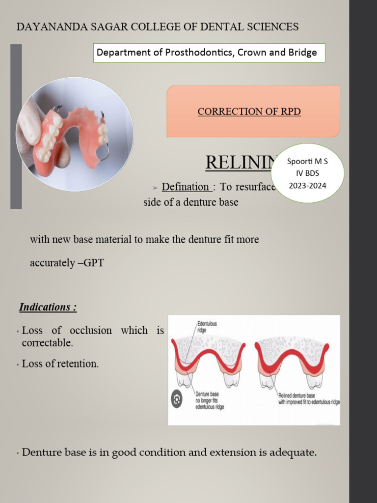 CORRECTION OF RPD new | PDF | Dentures | Mouth