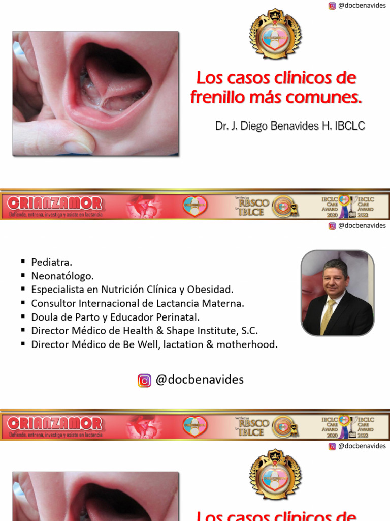 Frenillo Crianzamor Primera Charla | PDF | Amamantamiento ...